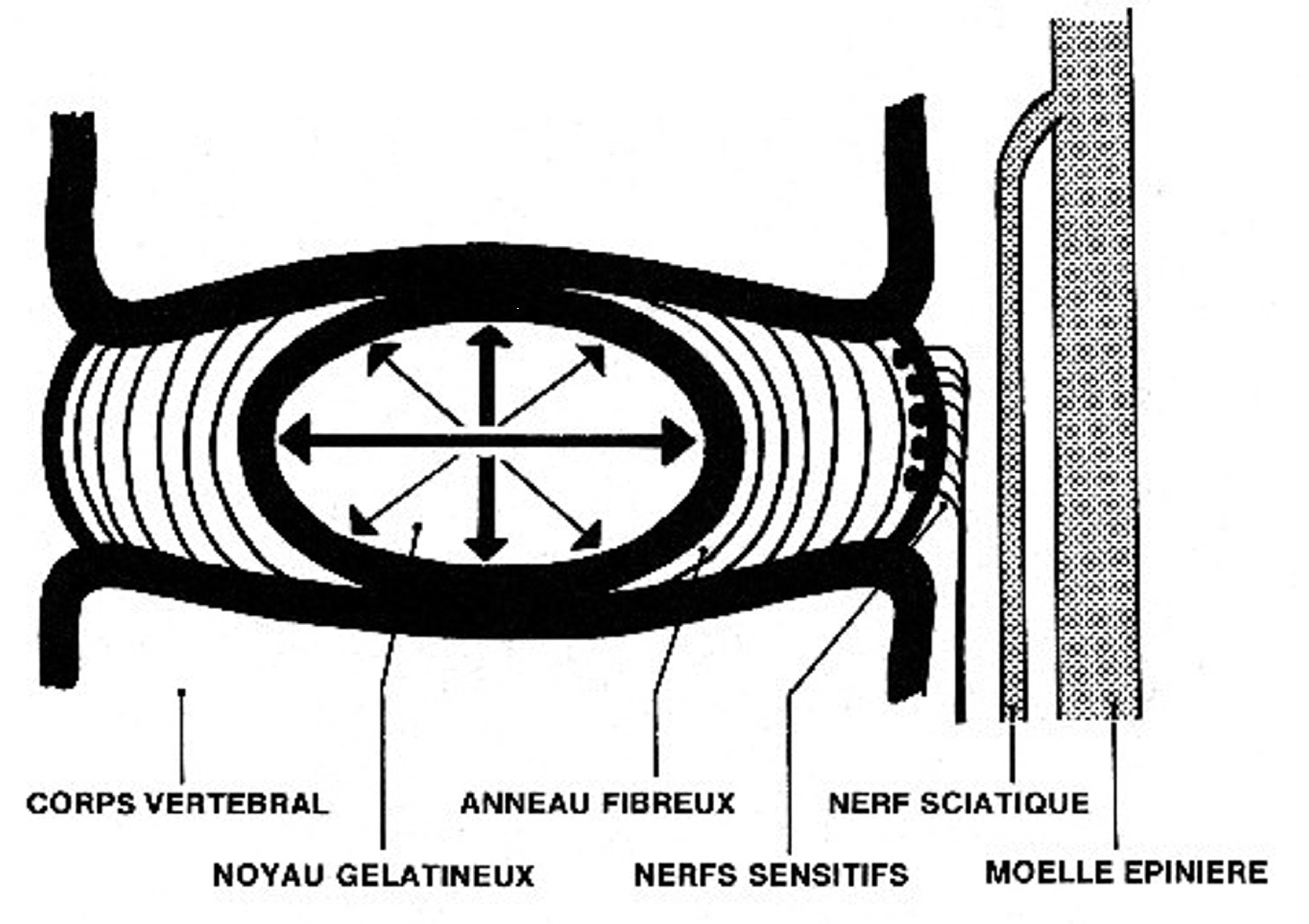 Pressions discales et rétraction des ischios jambiers - YOGA AZUR